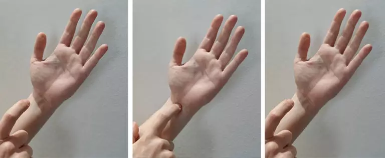 Carpal tunnel syndrome: identification and management - The ...