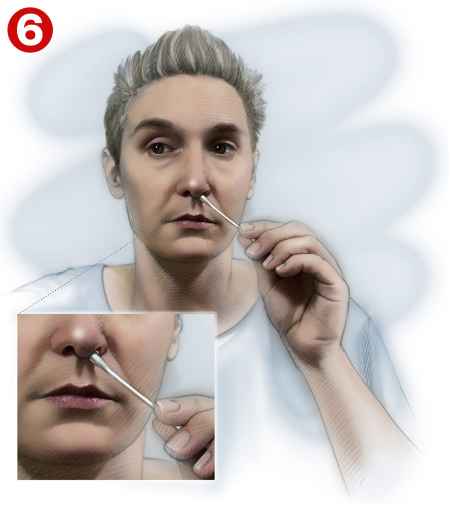 How to counsel patients on the administration of nasal sprays, drops ...