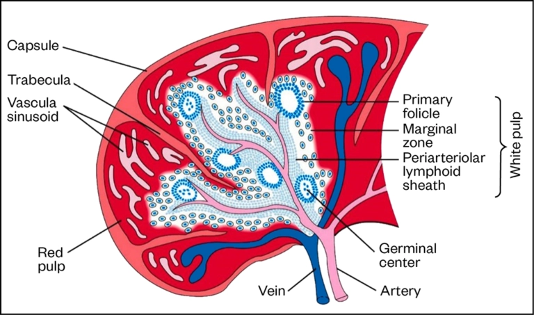 Asplenia and hyposplenism in adults: recognition, diagnosis and ...