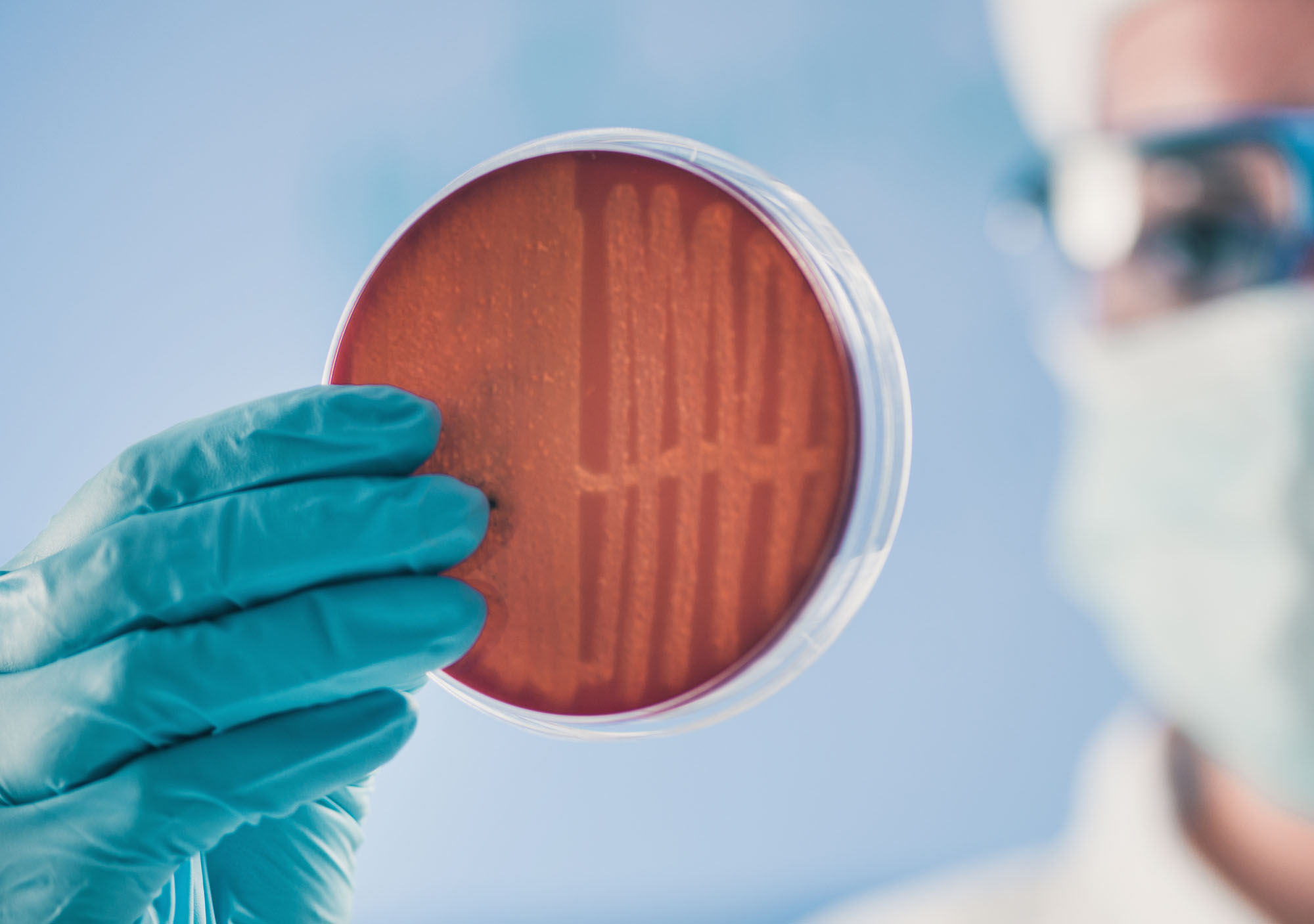 MRSA Diagnosis Screening And Management The Pharmaceutical Journal MRSA Diagnosis Screening And Management The Pharmaceutical Journal