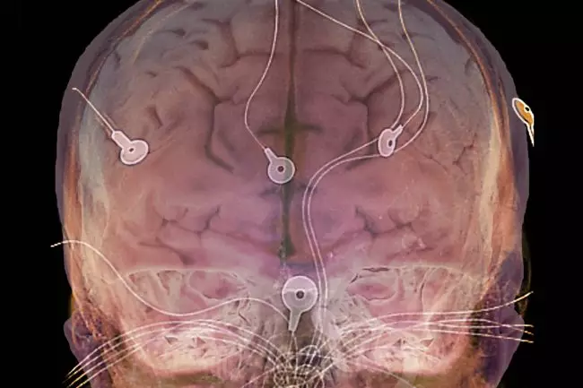 Epilepsy: symptoms and diagnosis - The Pharmaceutical Journal