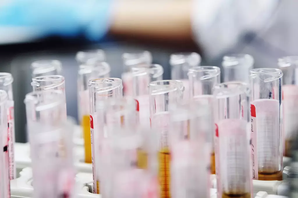 Pharmacogenomic testing in community pharmacies to be considered as ...