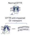Clinical impact of CFTR modulator therapy roll-out - The Pharmaceutical ...