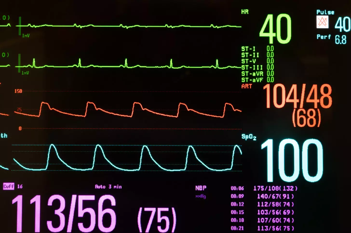Digoxin monitoring and toxicity management - The Pharmaceutical Journal
