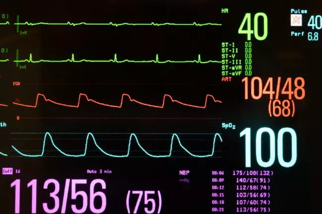 Digoxin monitoring and toxicity management - The Pharmaceutical Journal