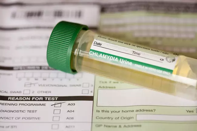 Chlamydia: screening, diagnosis and management - The Pharmaceutical Journal