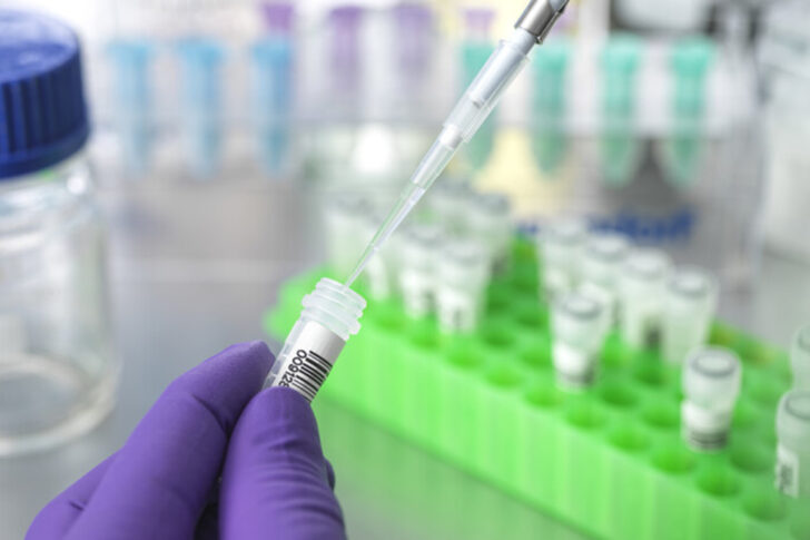 Pharmacogenomic testing pilot to start in general practice from June ...