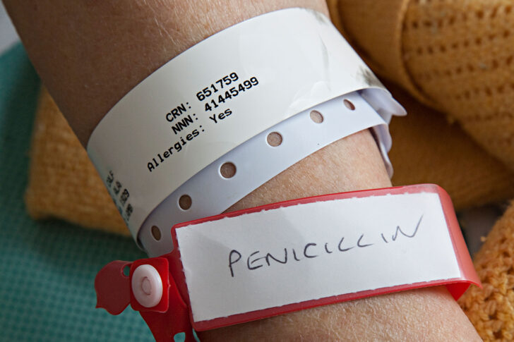 Pharmacist coordinating UK participation in global penicillin allergy ...