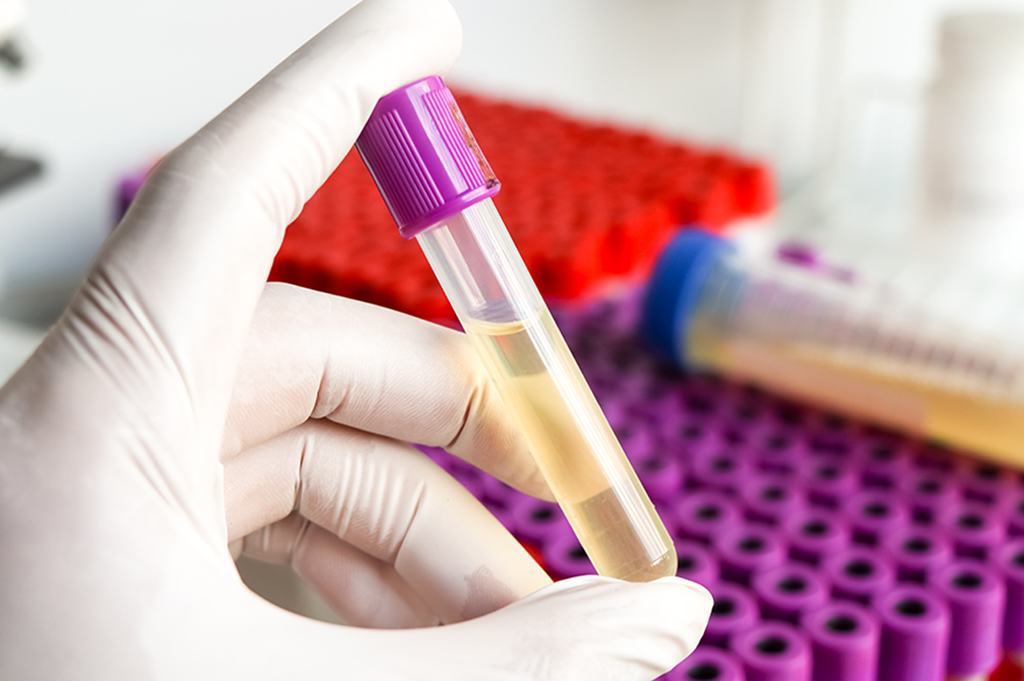 Rapid UTI test wins £8m Longitude Prize on Antimicrobial Resistance ...