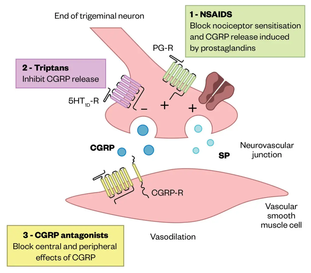 Migraine: pathophysiology, recognition and management - The ...