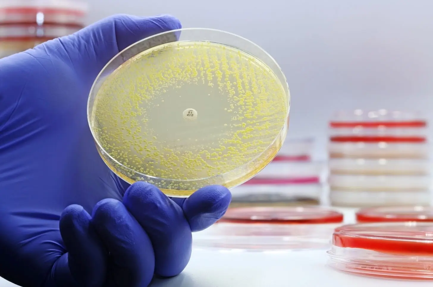 Antibiotic-resistant infections at highest level since COVID-19 ...