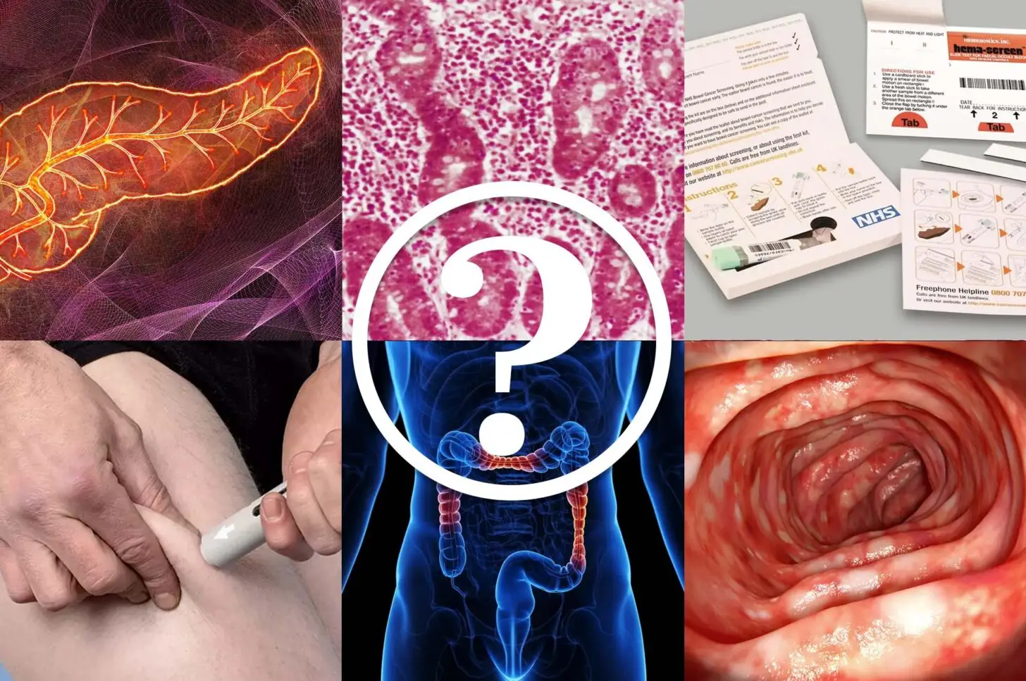 Test your knowledge of gastrointestinal conditions - The Pharmaceutical ...