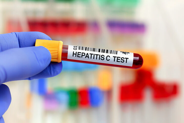 Genomics surveillance programme for hepatitis C launched by UK Health ...