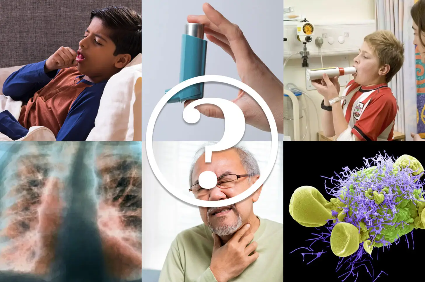 Test your knowledge of respiratory tract diseases - The Pharmaceutical ...