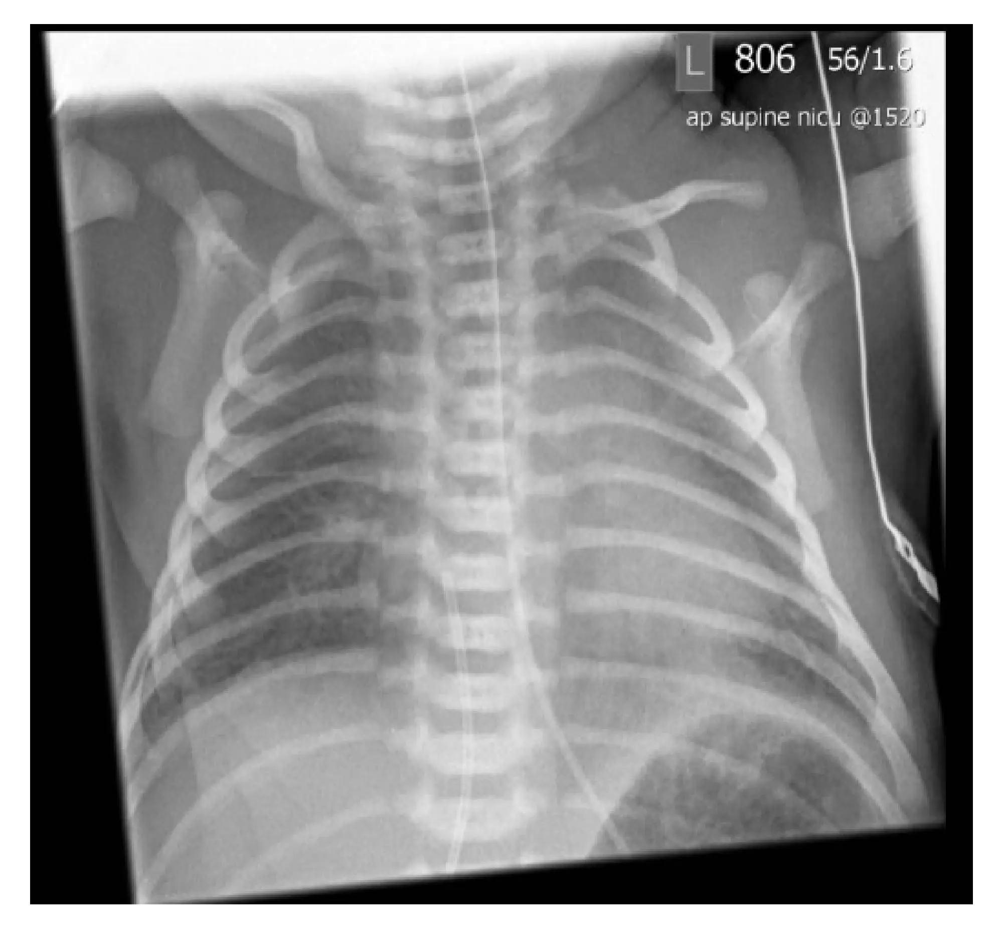 Case-based learning: pharmacy involvement in congenital heart disease ...