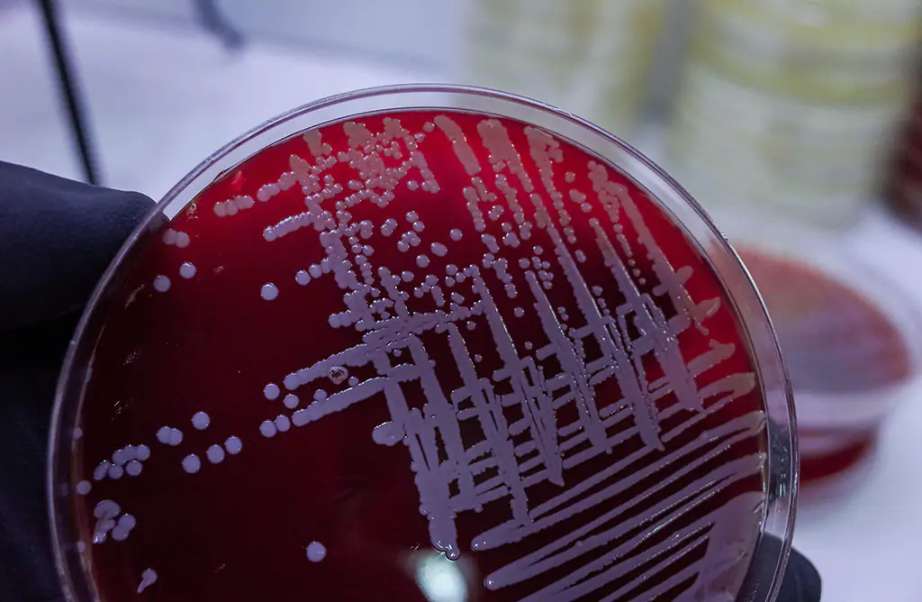First health security risk assessment highlights risk of respiratory ...